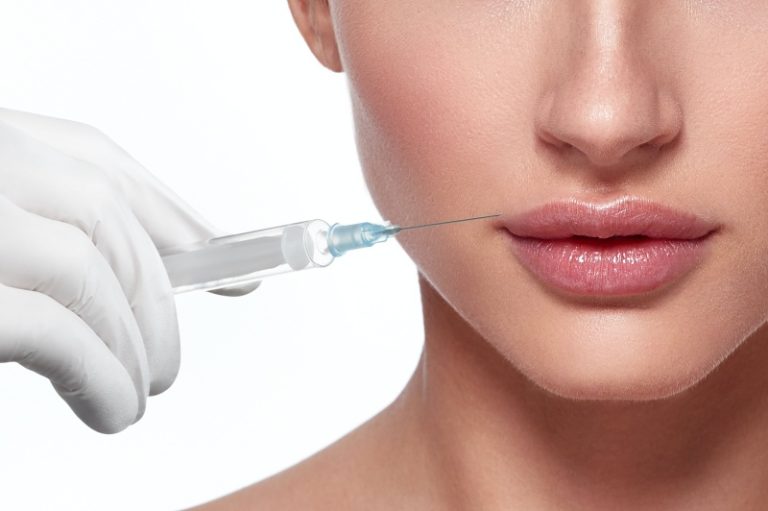 Dissolving Lip Fillers: Natural and Injection Method Explained