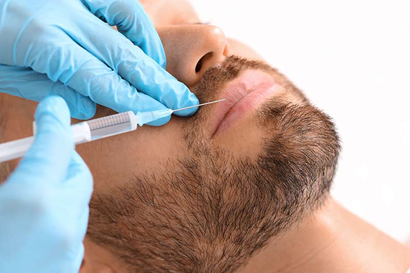 Lip Filler for Men {Benefits, Results, Aftercare Tips}